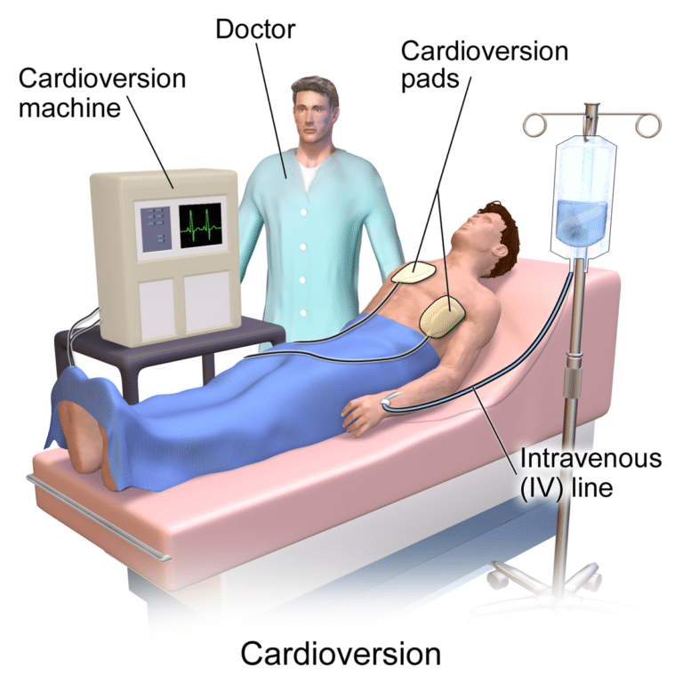 Cardioversion Explained - Central Georgia Heart Center