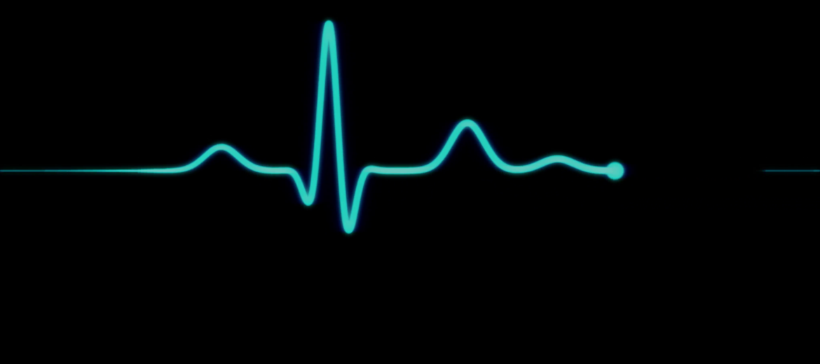 Cardioversion Explained – Central Georgia Heart Center